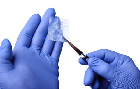 Amniotic Tissue Graft | Skin Substitutes | Skin Substitutes for Wound ...