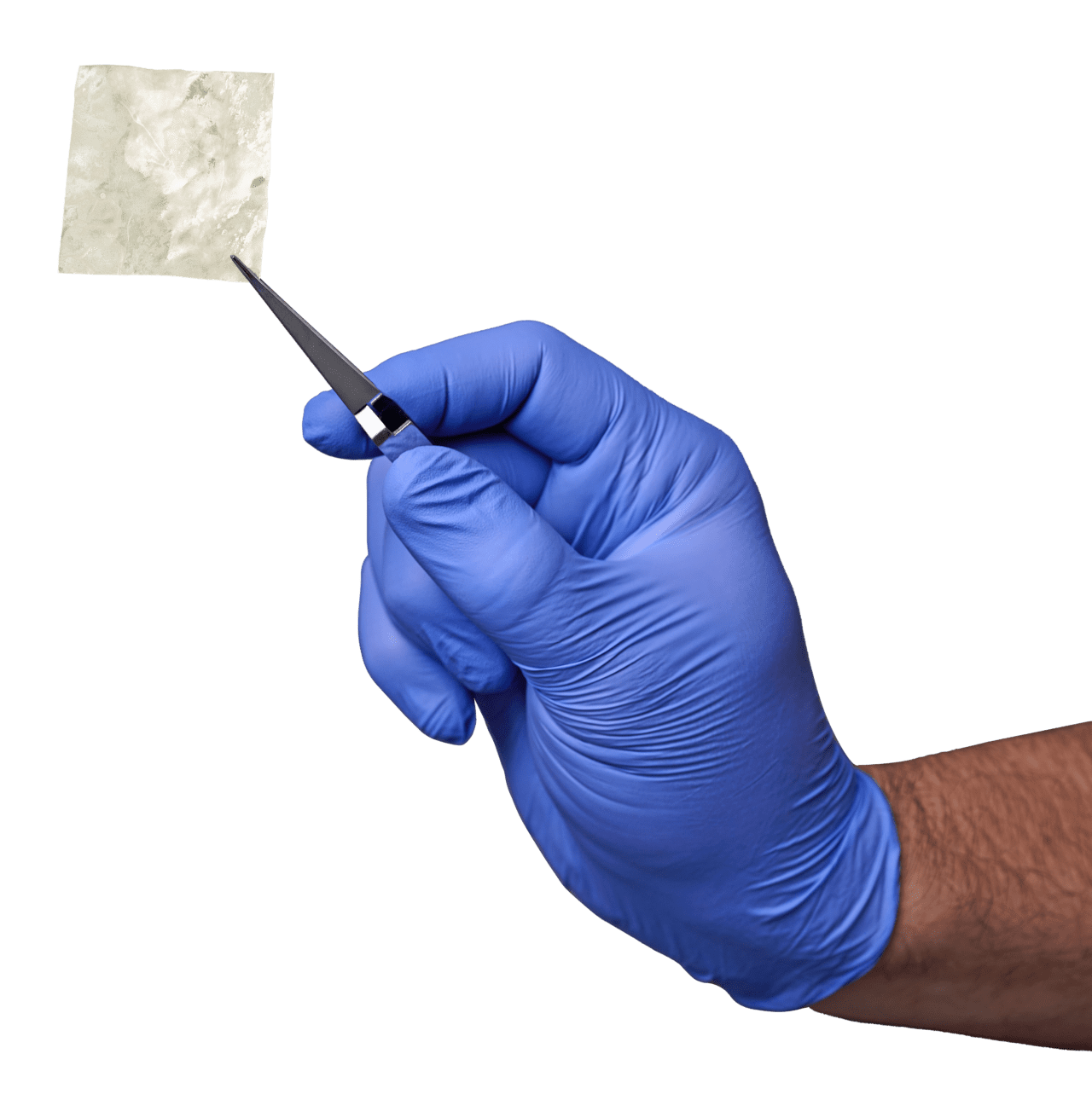 Amniotic Tissue Graft | Skin Substitutes | Skin Substitutes for Wound ...